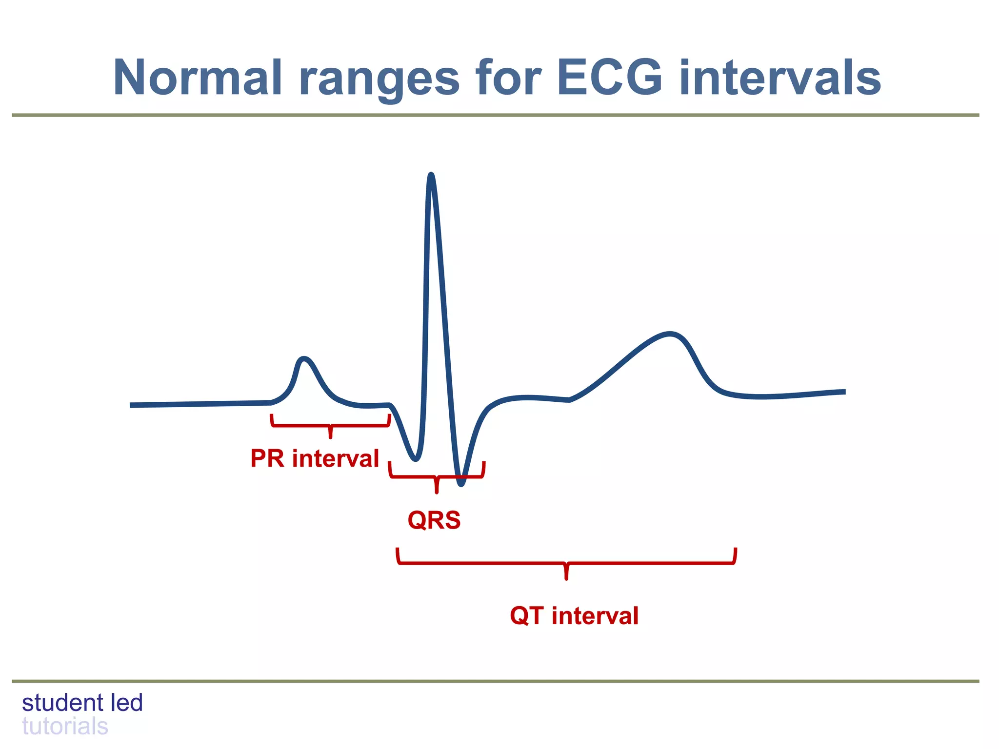 The Basics of ECG Interpretation | PPTX