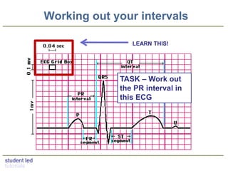 The Basics of ECG Interpretation | PPTX