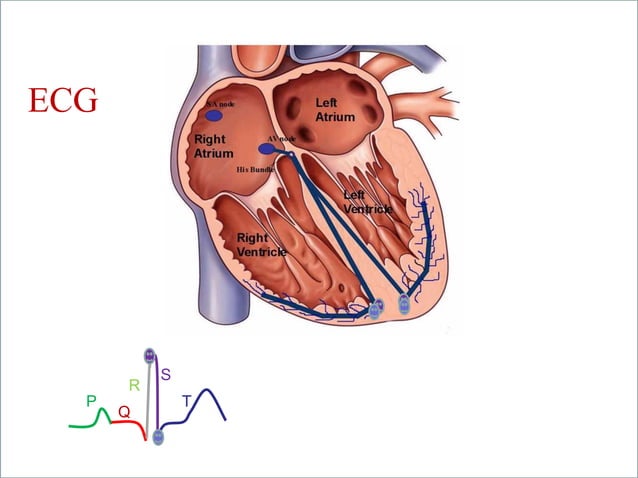 The Basics of ECG Interpretation