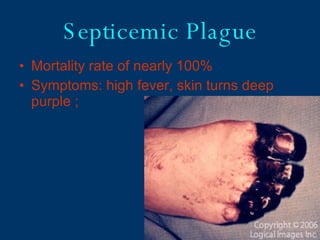 The Black Plague | PPT