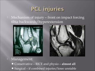 The Common Knee Injuries Experience by Professional Sportsmen | PPT