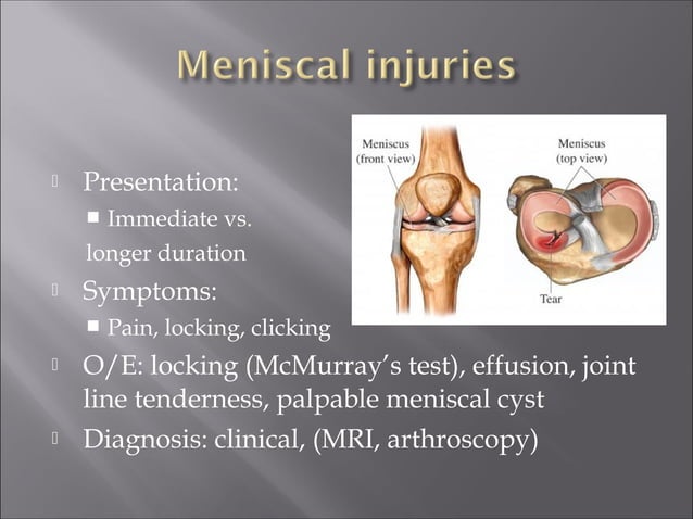 The Common Knee Injuries Experience by Professional Sportsmen | PPT
