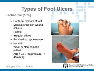 The-Diabetic-Foot-Diab-Ed-2014.pdf
