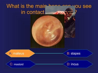 The Eye And Ear | PPT | Ear, Nose and Throat Conditions | Diseases and ...