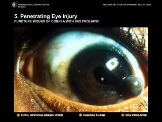 the eye in primary care | PPT