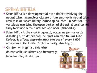 Birth Defects | PPT
