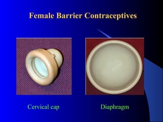 The female condom | PPT