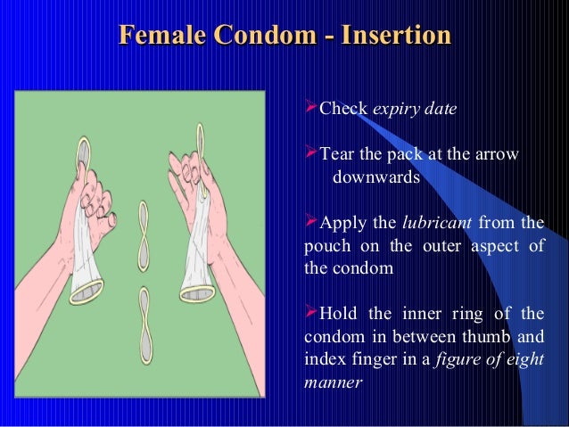 The Female Condom