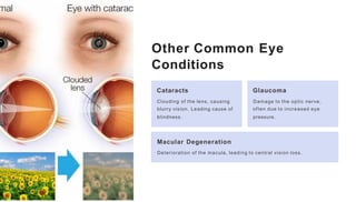 The-Marvelous-Eye1 2.pdf presentation pptx | PDF