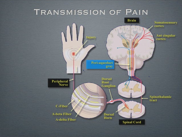 疼痛機制 The mechanism of Pain | PPT | Free Download