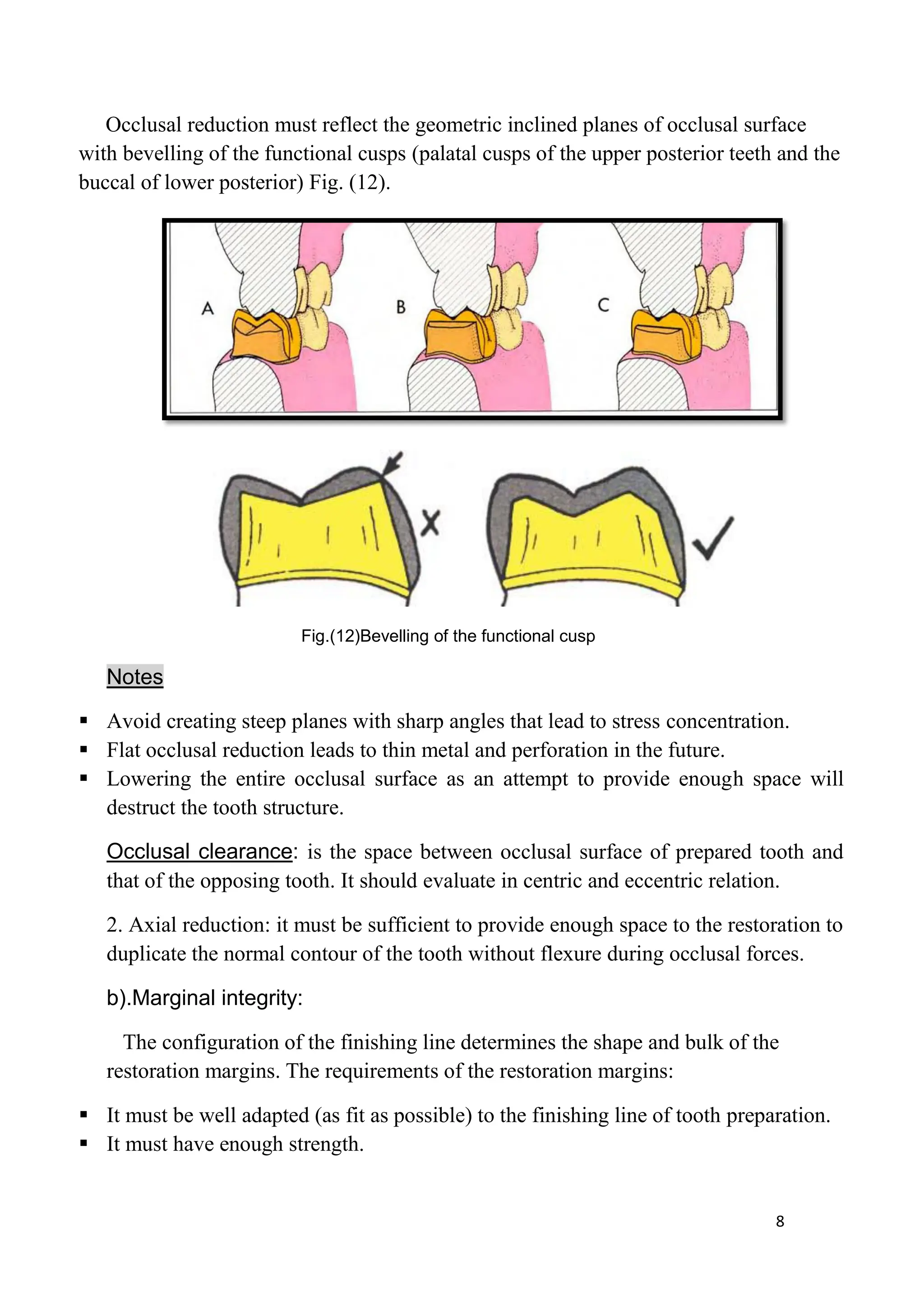 The-principles-of-tooth-preparation-may-be-divided-into-three-broad ...