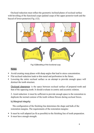The-principles-of-tooth-preparation-may-be-divided-into-three-broad ...