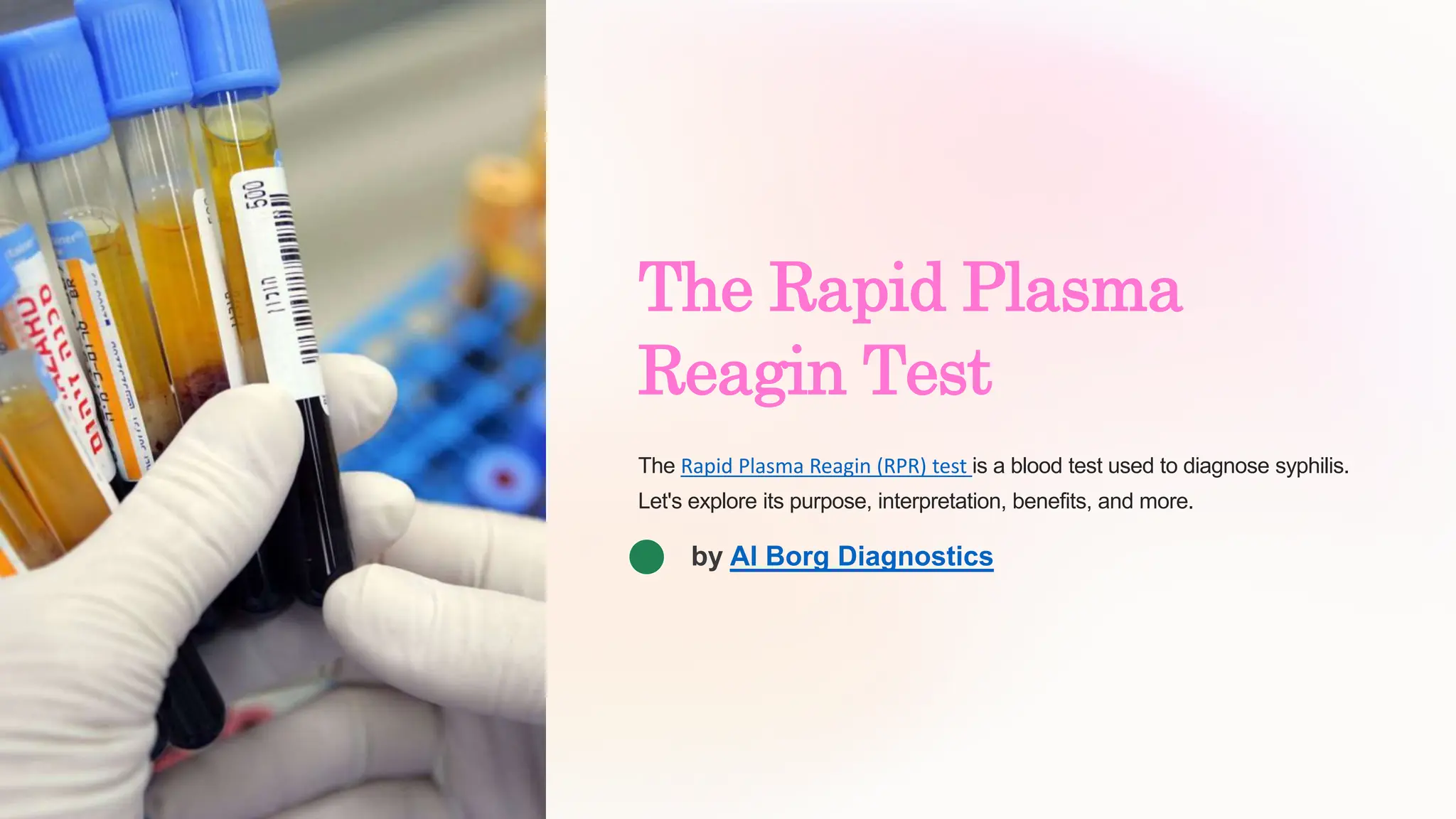 The-Rapid-Plasma-Reagin-Test Alborg.pptx