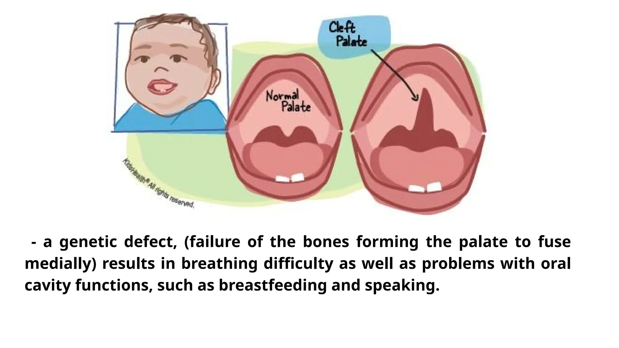 The-Respiratory-System.pptx anaphy subject | PPTX