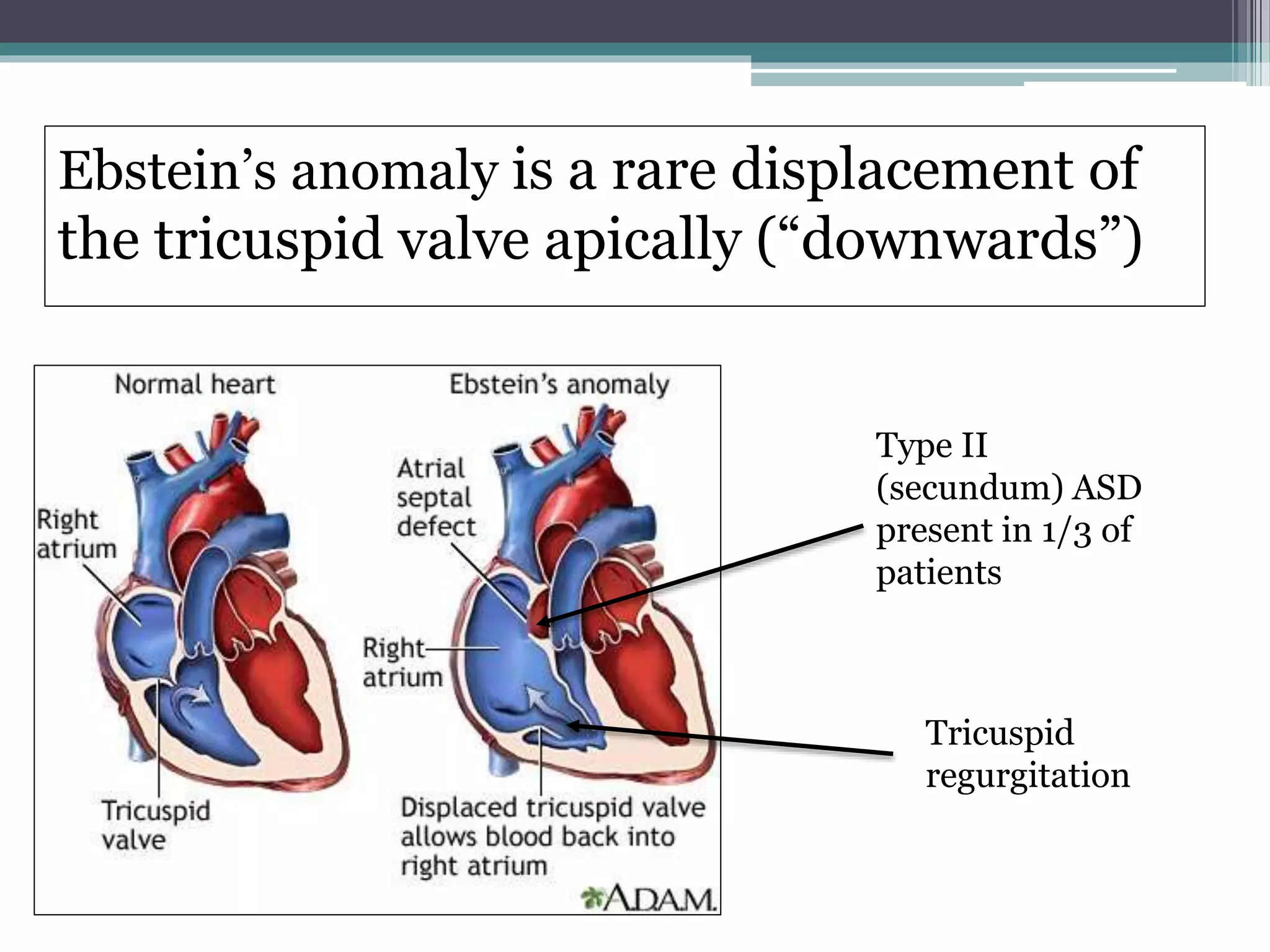The Role of Structural Proteins in Normal and Abnormal Heart ...