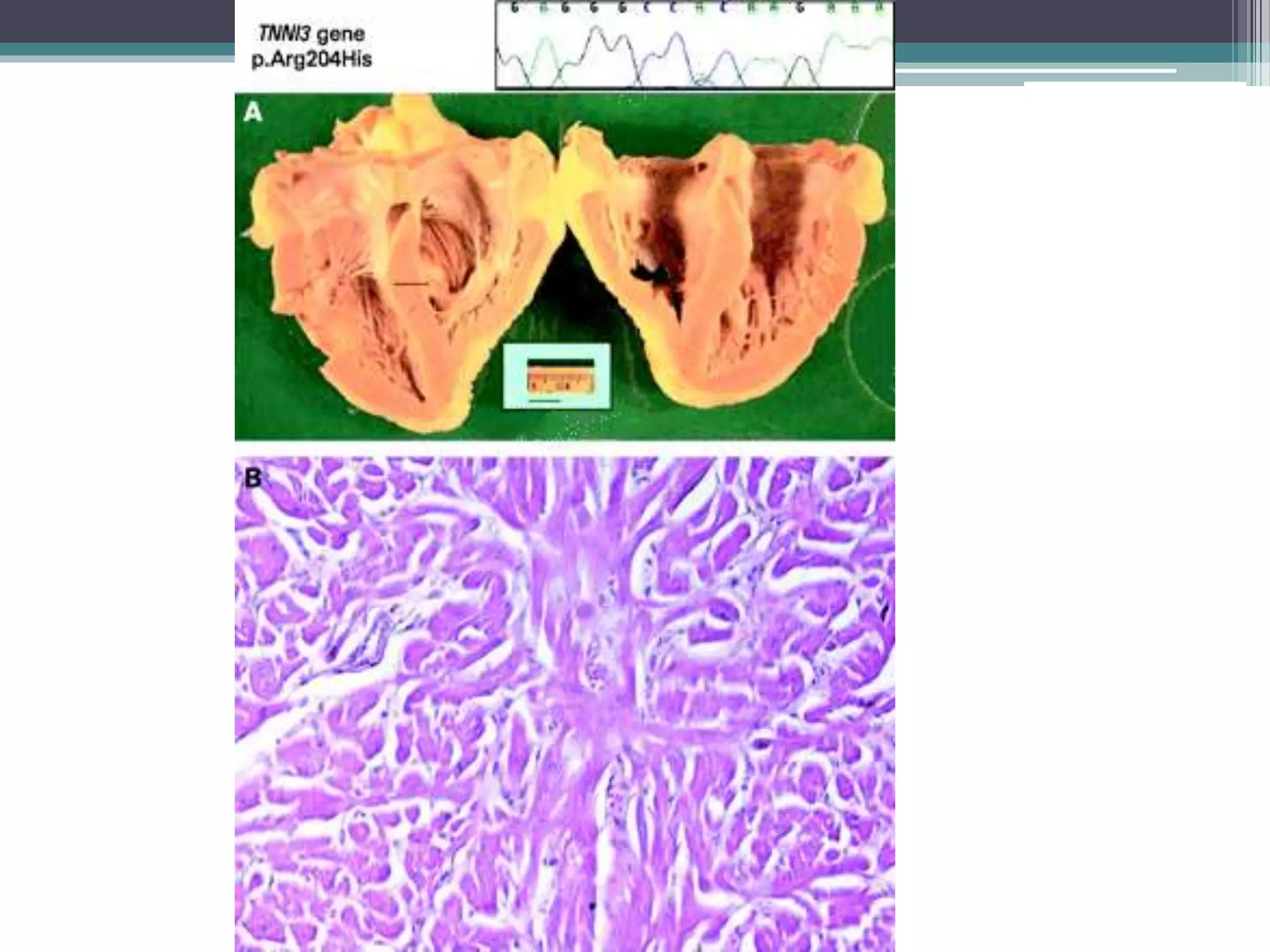 The Role of Structural Proteins in Normal and Abnormal Heart ...