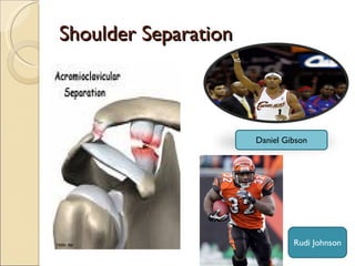 The shoulder-injuries-1223055603930839-8 | PPT