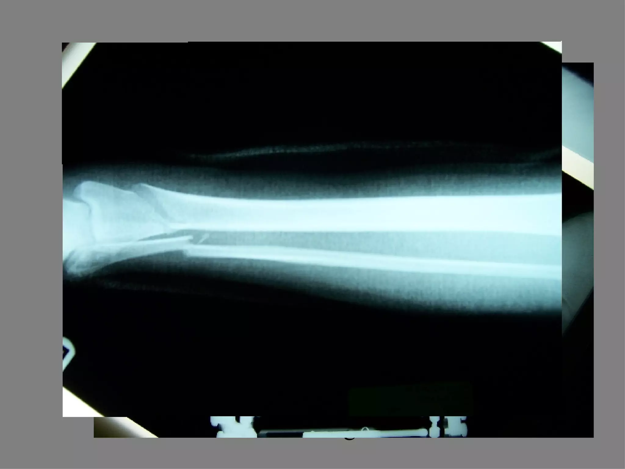 The Skeletal System | PPT | Death, Injury, or Military Conflict ...
