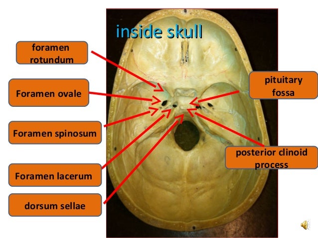 The Skull