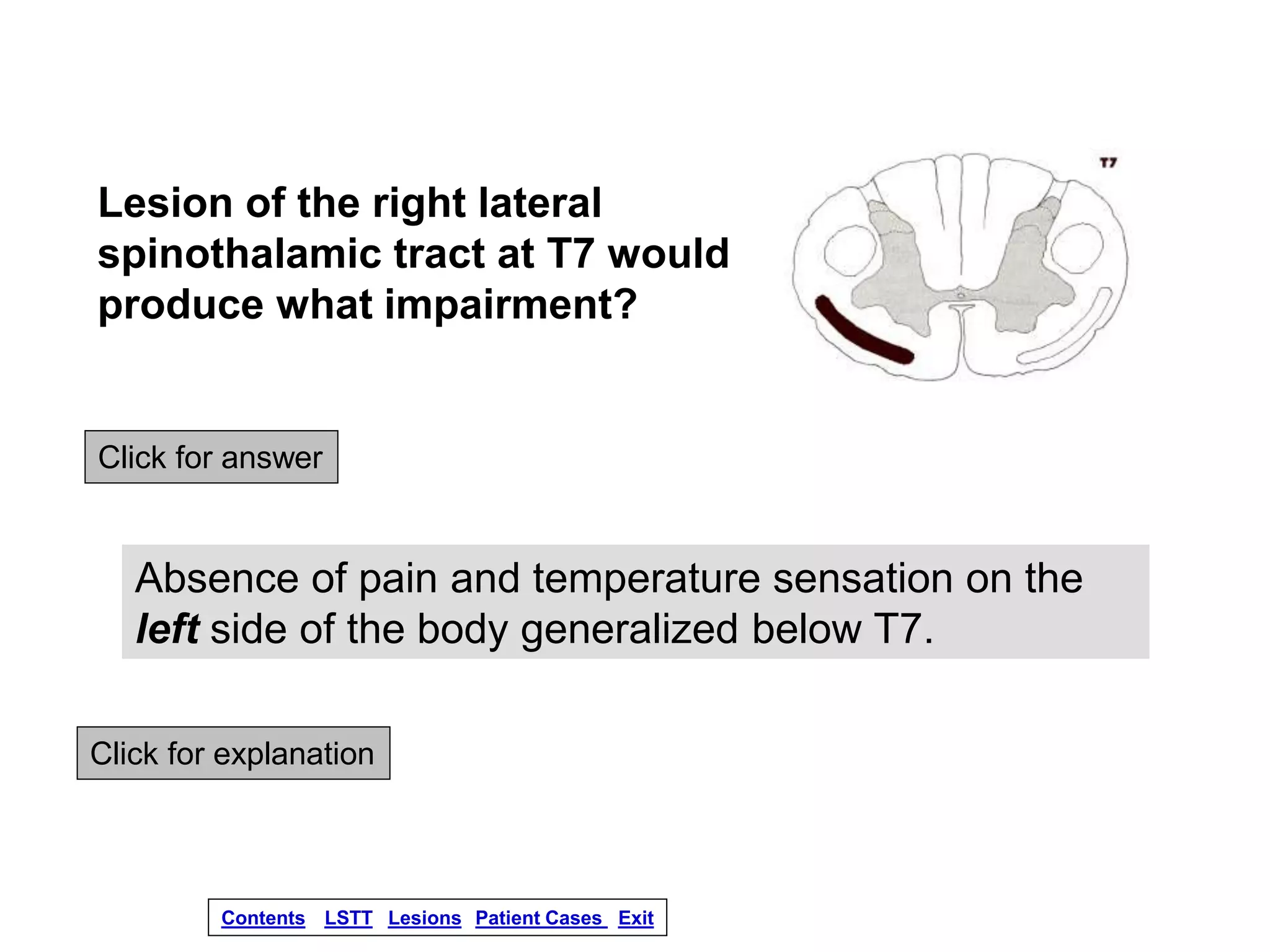 the-spinothalamic-system.ppsx