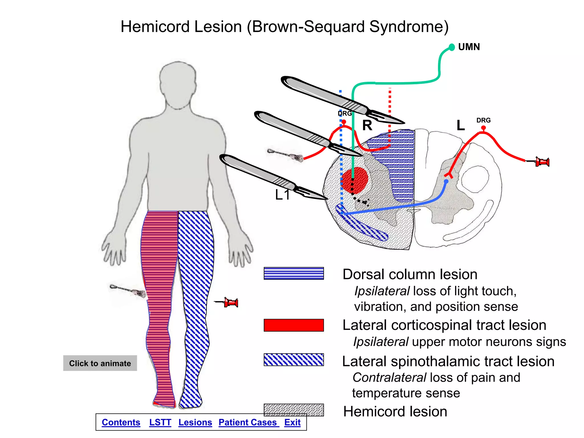 the-spinothalamic-system.ppsx