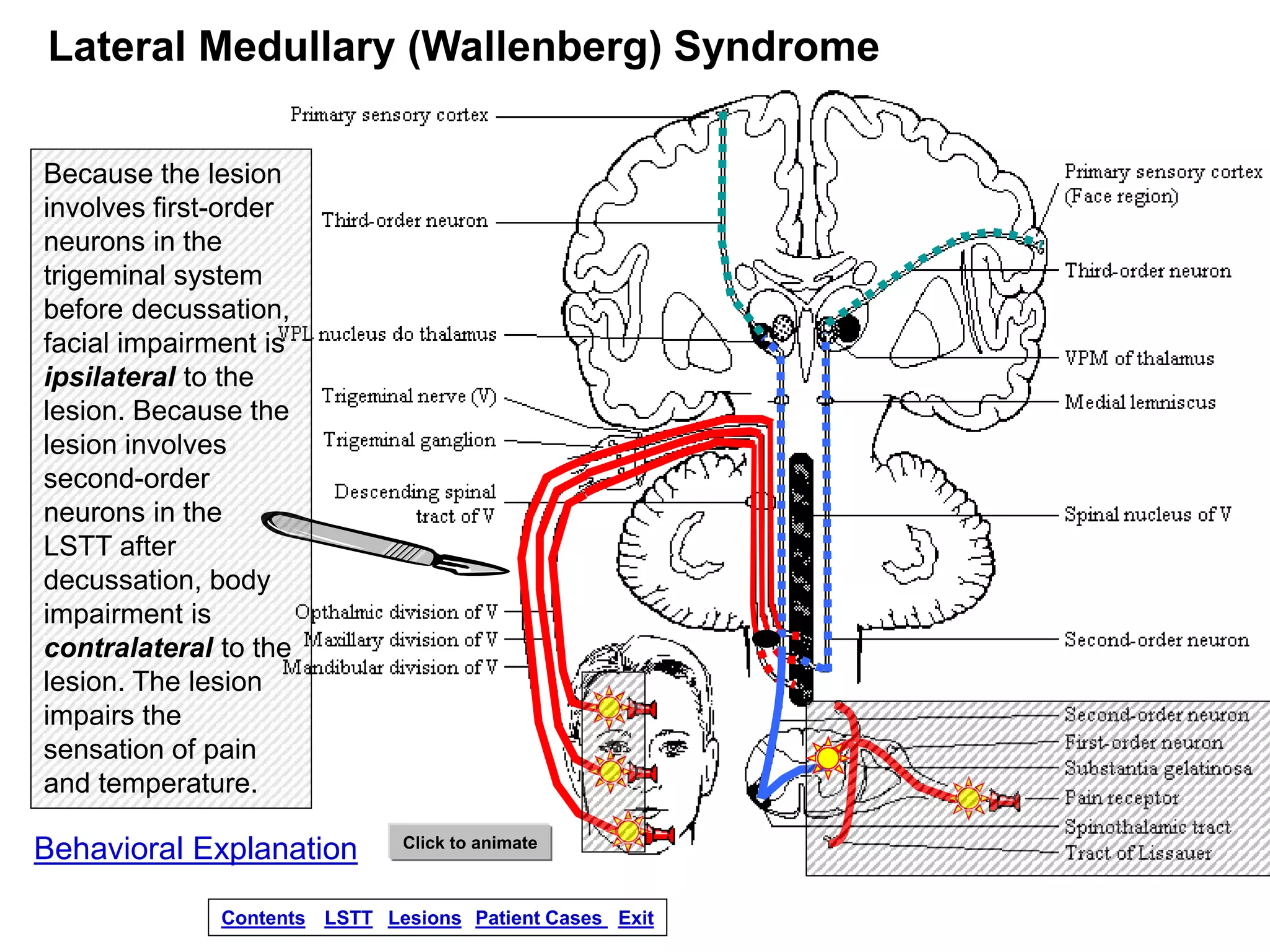 the-spinothalamic-system.ppsx