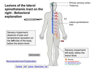 the-spinothalamic-system.ppsx