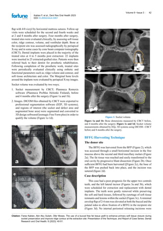 the-use-of-a-buccal-free-fat-tissue-graft-to-enhance-primary-soft ...