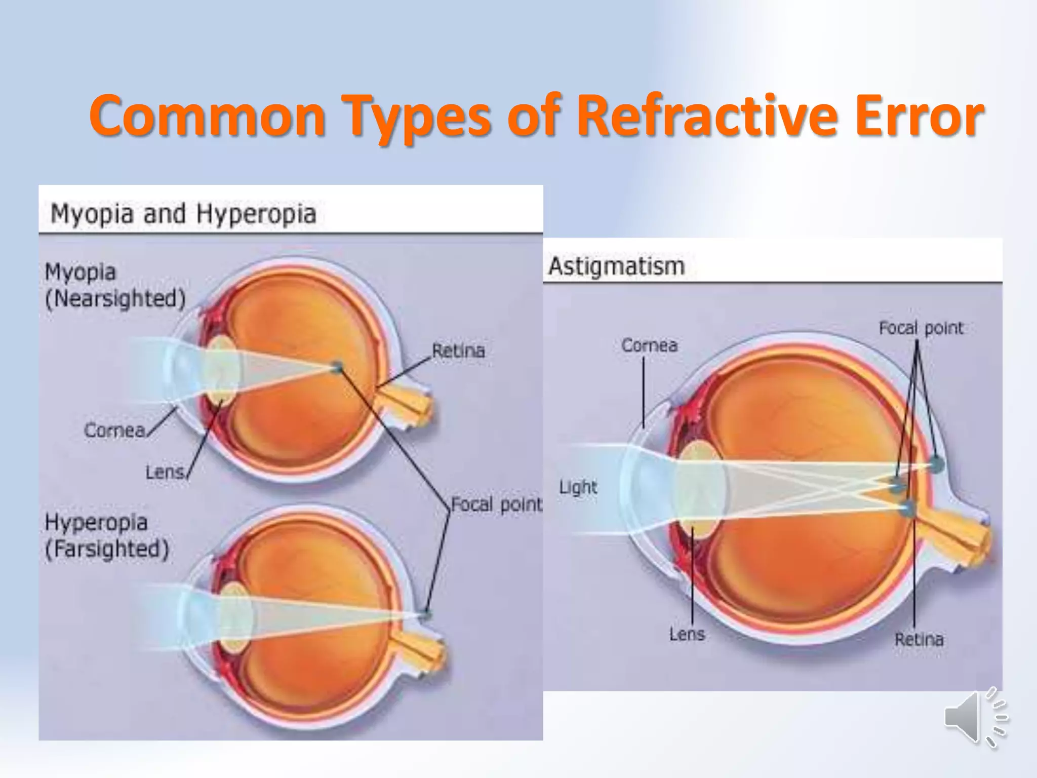 The Visual System | PPTX
