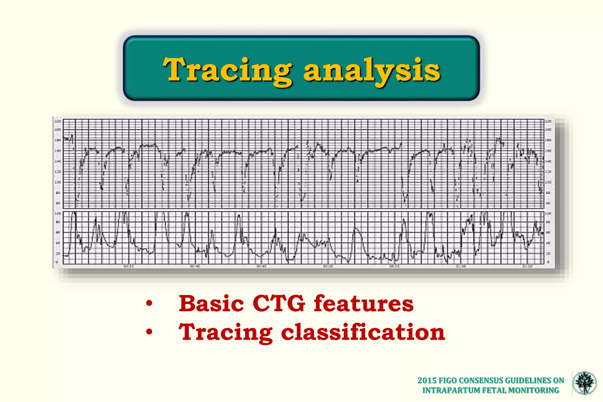 The 2015 FIGO consensus guidelines on intrapartum fetal monitoring ...