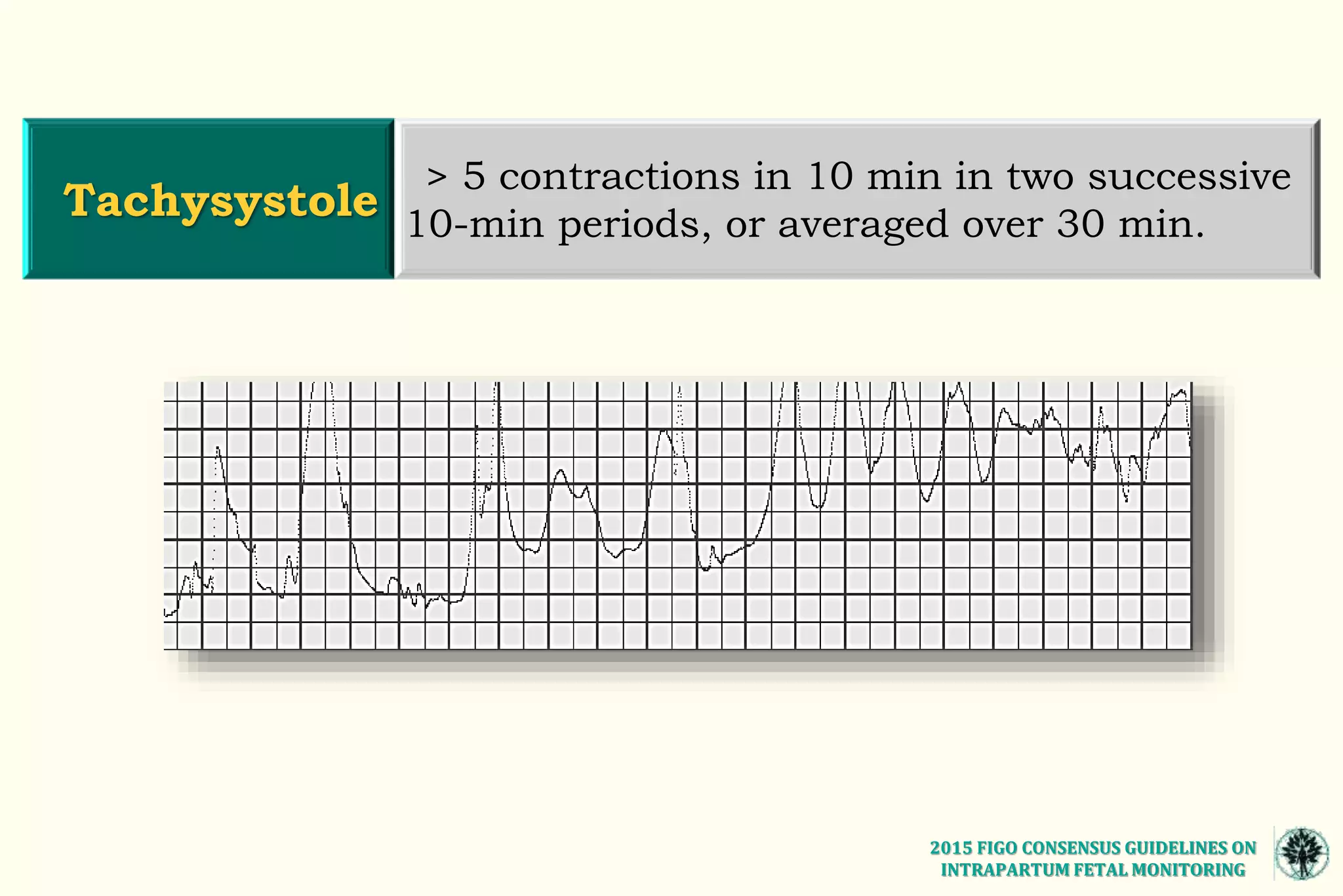 The 2015 FIGO consensus guidelines on intrapartum fetal monitoring ...
