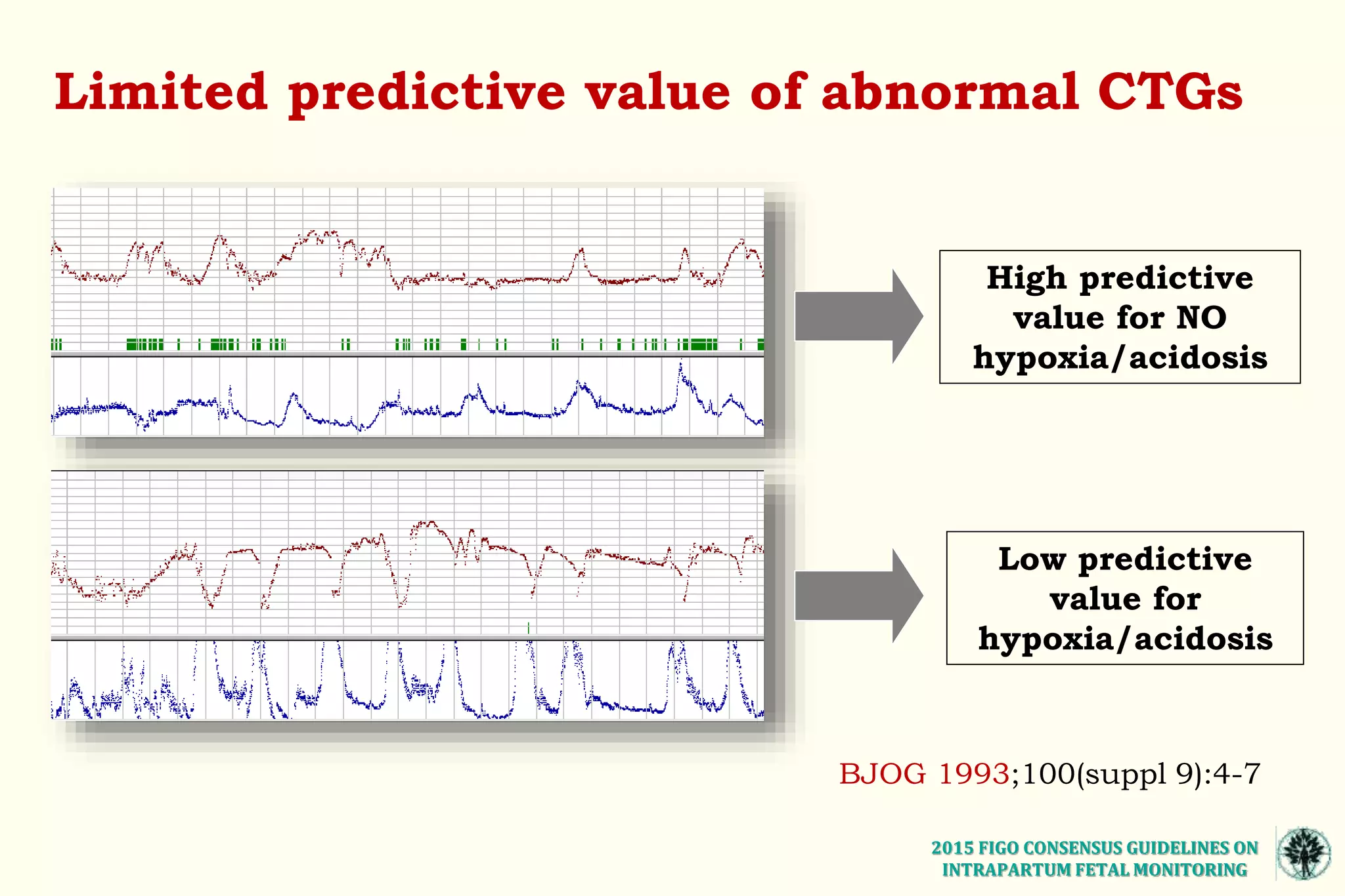 The 2015 FIGO consensus guidelines on intrapartum fetal monitoring ...