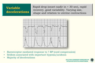 The 2015 FIGO consensus guidelines on intrapartum fetal monitoring ...