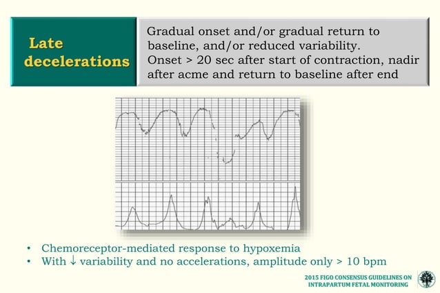 The 2015 FIGO consensus guidelines on intrapartum fetal monitoring ...