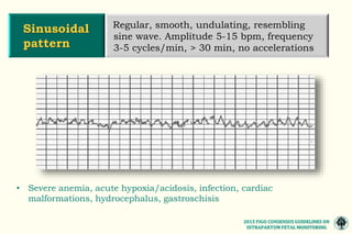 The 2015 FIGO consensus guidelines on intrapartum fetal monitoring ...