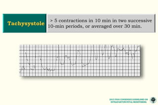 The 2015 FIGO consensus guidelines on intrapartum fetal monitoring ...