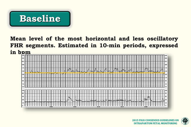 The 2015 FIGO consensus guidelines on intrapartum fetal monitoring ...