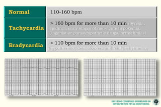 The 2015 FIGO consensus guidelines on intrapartum fetal monitoring ...