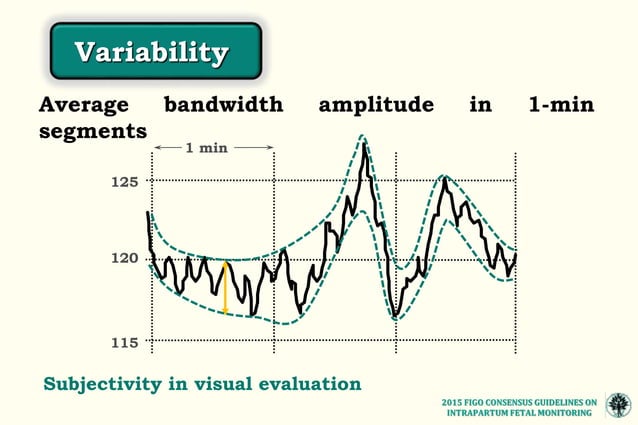 The 2015 FIGO consensus guidelines on intrapartum fetal monitoring ...