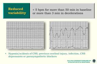 The 2015 FIGO consensus guidelines on intrapartum fetal monitoring ...