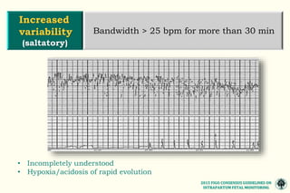 The 2015 FIGO consensus guidelines on intrapartum fetal monitoring ...
