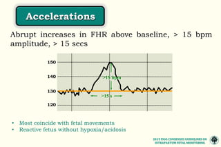 The 2015 FIGO consensus guidelines on intrapartum fetal monitoring ...
