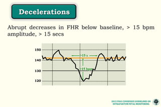 The 2015 FIGO consensus guidelines on intrapartum fetal monitoring ...