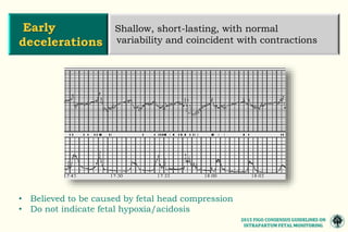 The 2015 FIGO consensus guidelines on intrapartum fetal monitoring ...