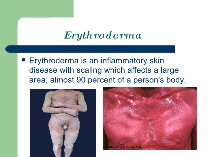 The%20 Integumentary%20 System[1]