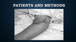 The pulseless pink hand after supracondylar fracture humerus | PPTX