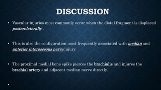 The pulseless pink hand after supracondylar fracture humerus | PPTX