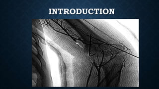 The pulseless pink hand after supracondylar fracture humerus | PPTX
