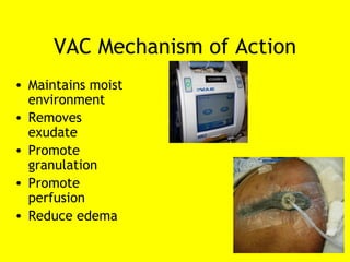 The 411 on wound care | PPT