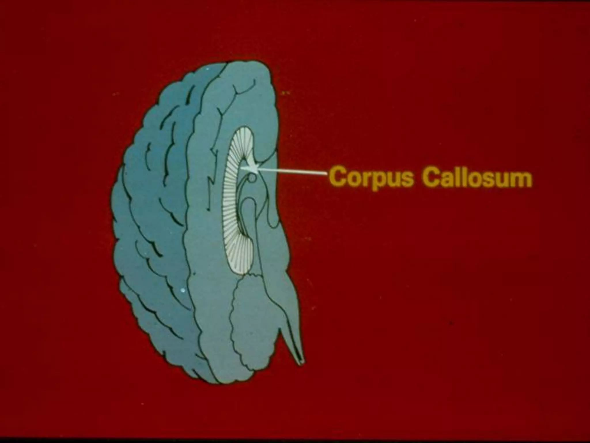 The 4MAT system | PPT